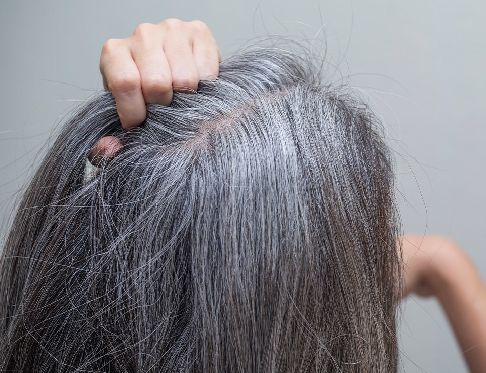 5 Signs Your Hair And Scalp Is Ageing – PHS HAIRSCIENCE